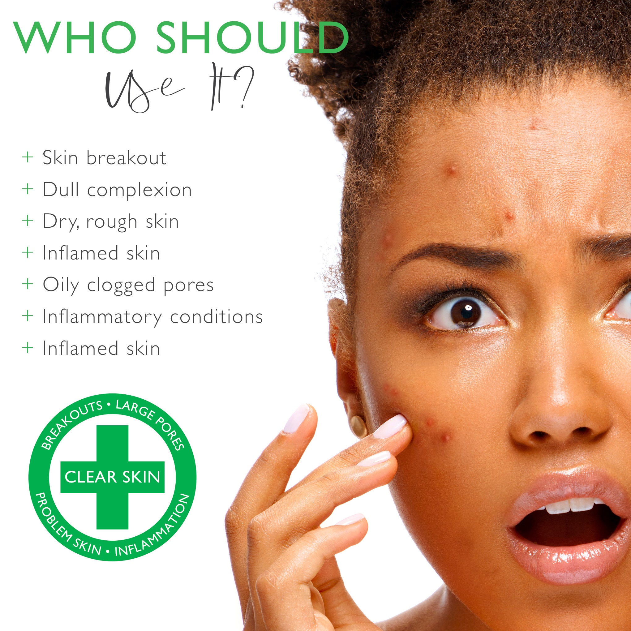 90 Capsules Problem Skin Super Prescription – Skin Nutrition SA